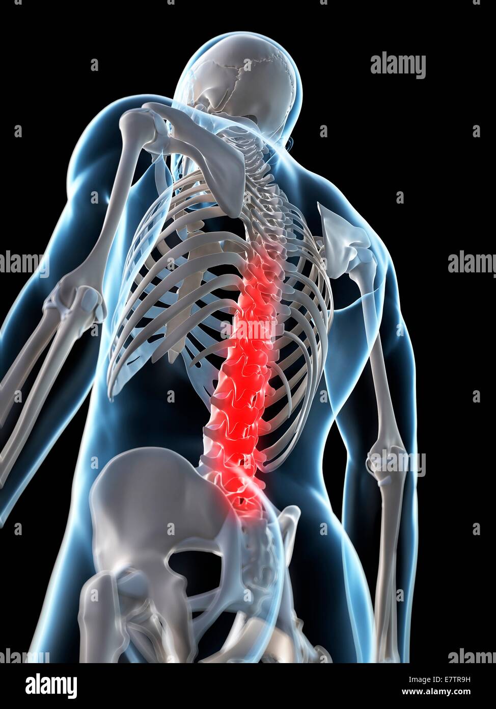 Human back pain, computer artwork Stock Photo - Alamy