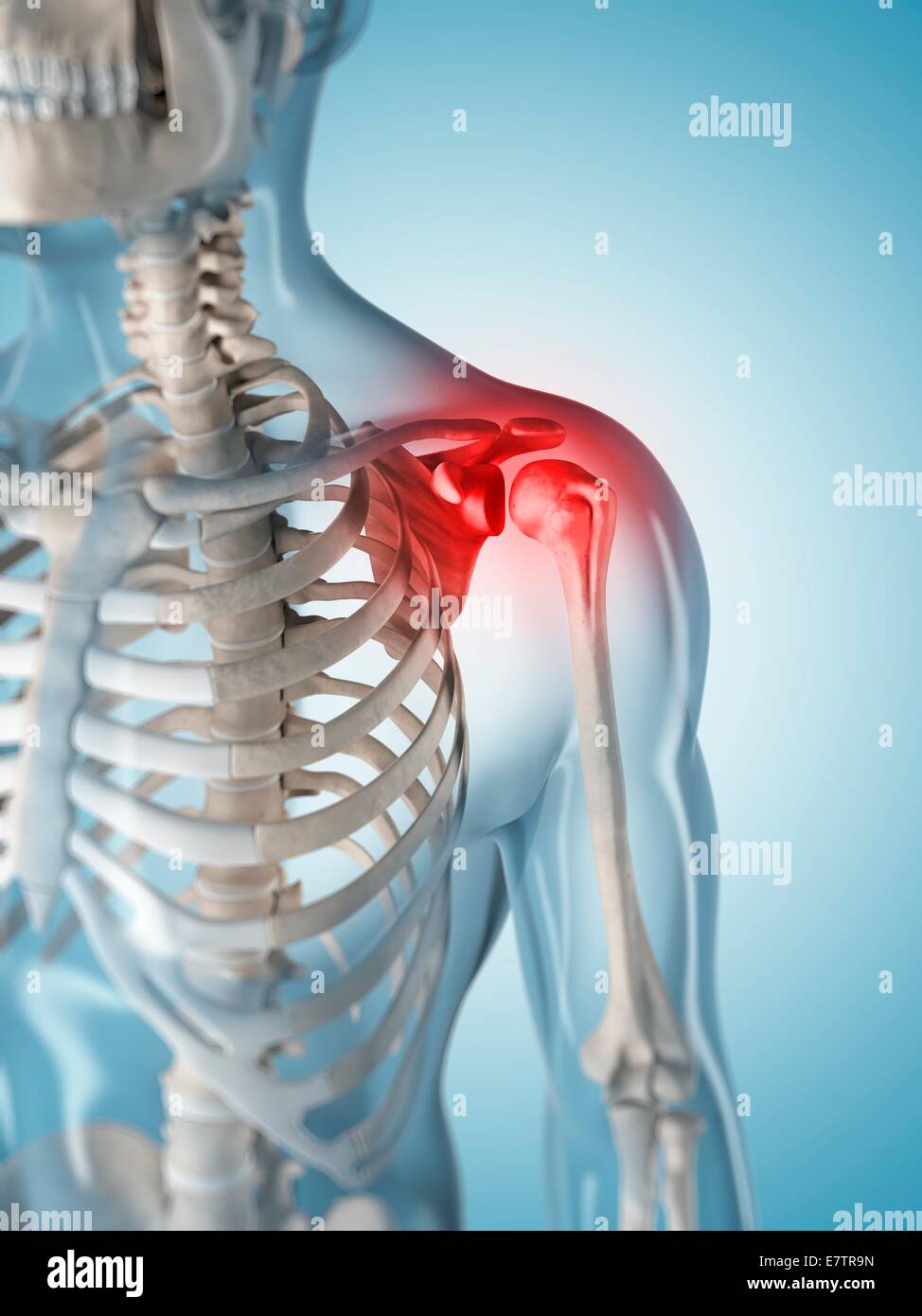 Shoulder pain and computer hi-res stock photography and images - Alamy