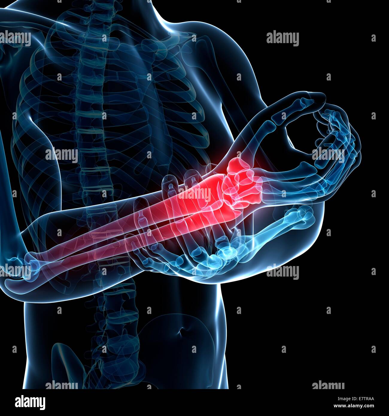 Close up human arm hi-res stock photography and images - Alamy