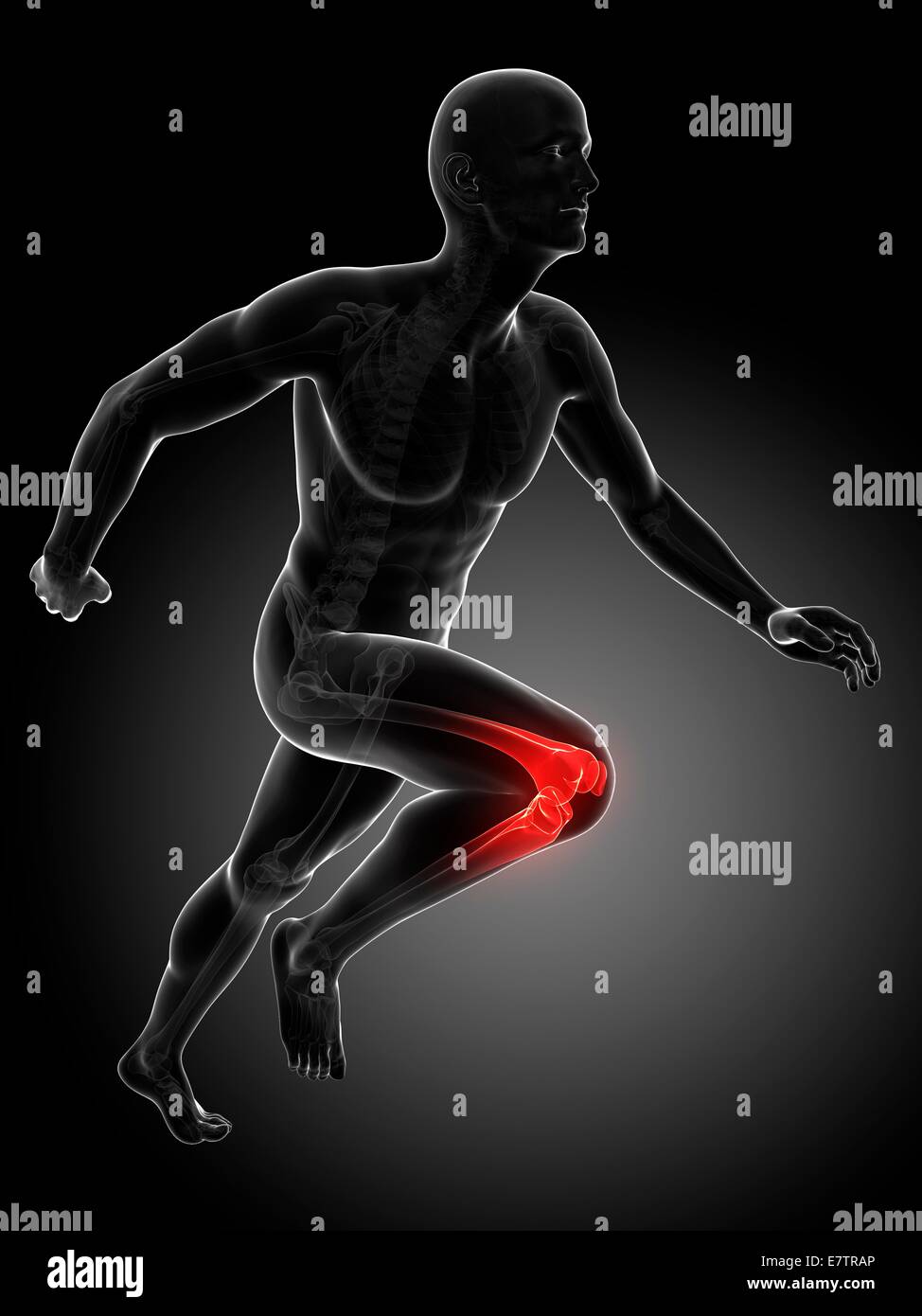 Runner's knee joint, computer artwork Stock Photo - Alamy