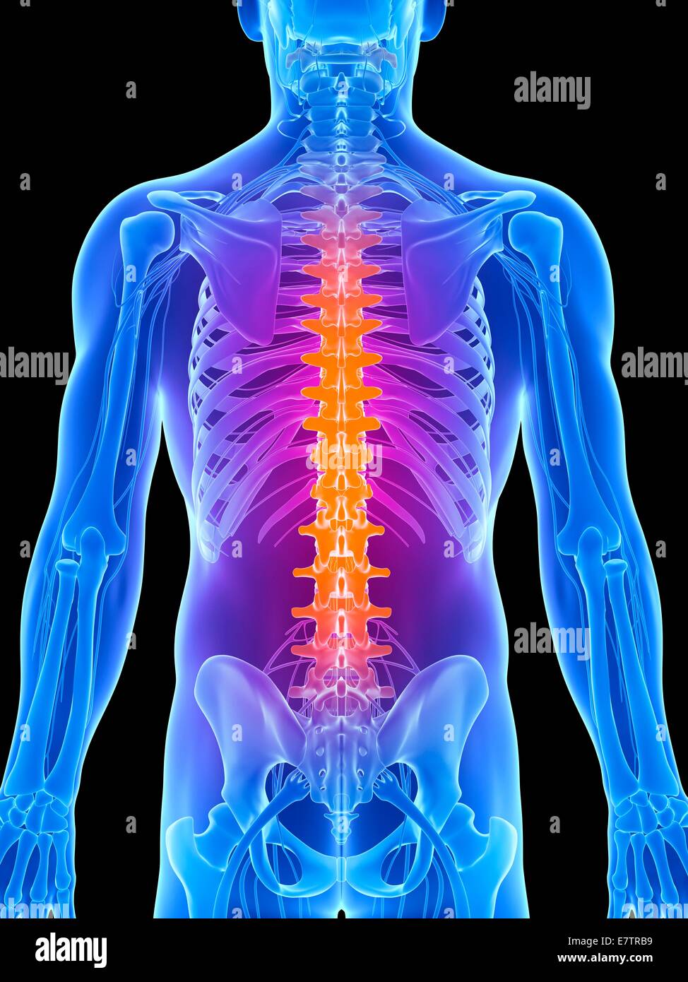 Human back pain, computer artwork Stock Photo - Alamy