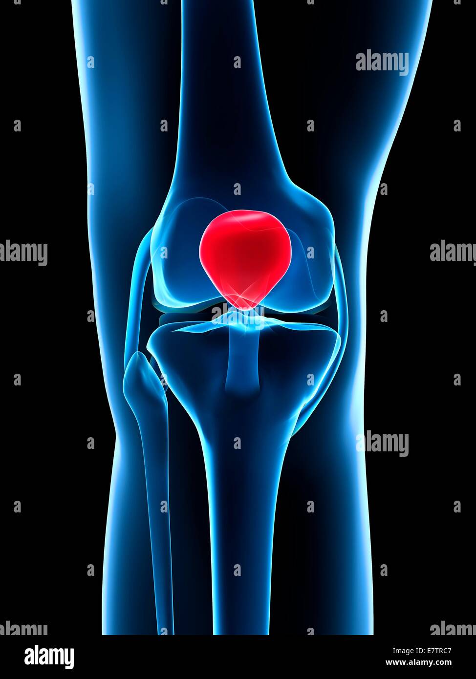 Human knee cap, computer artwork Stock Photo - Alamy