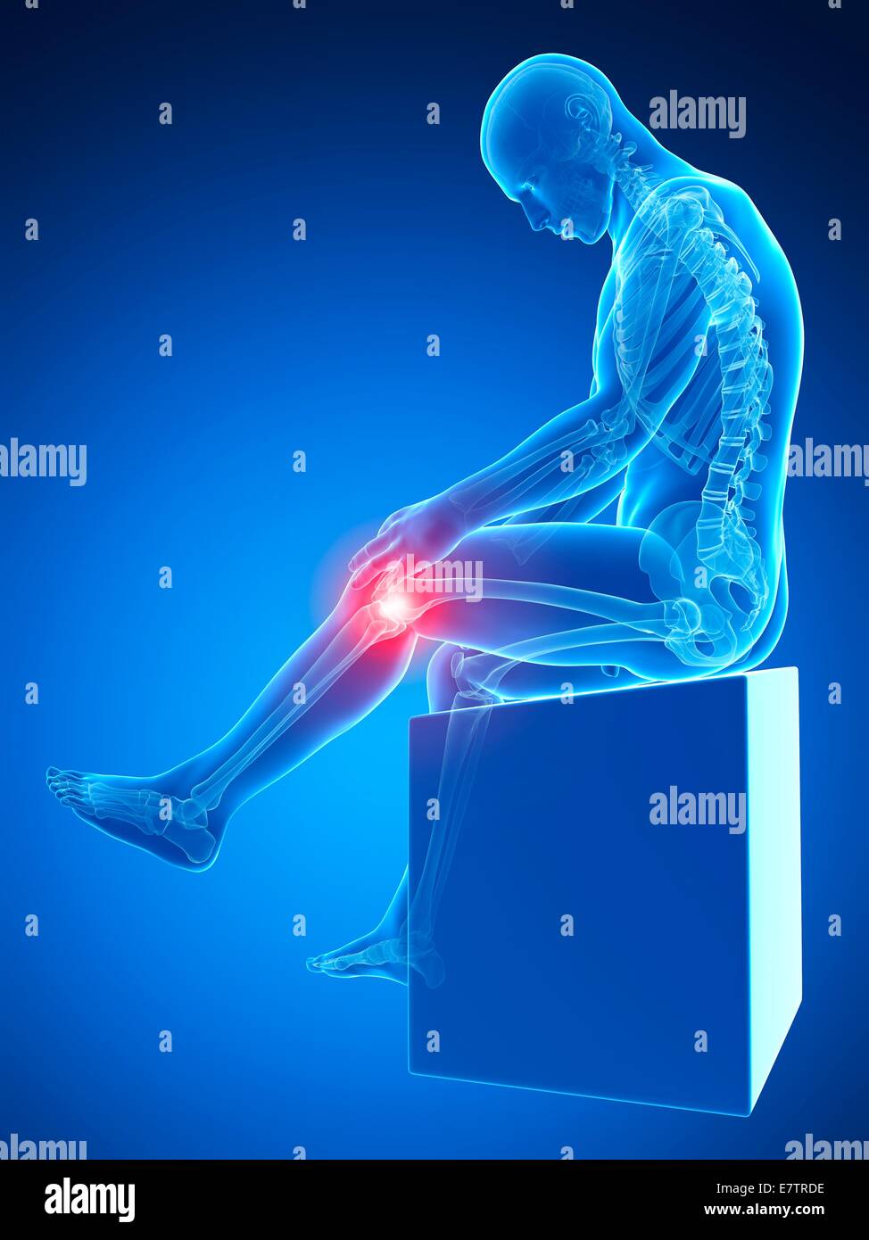 Human knee pain, computer artwork Stock Photo - Alamy