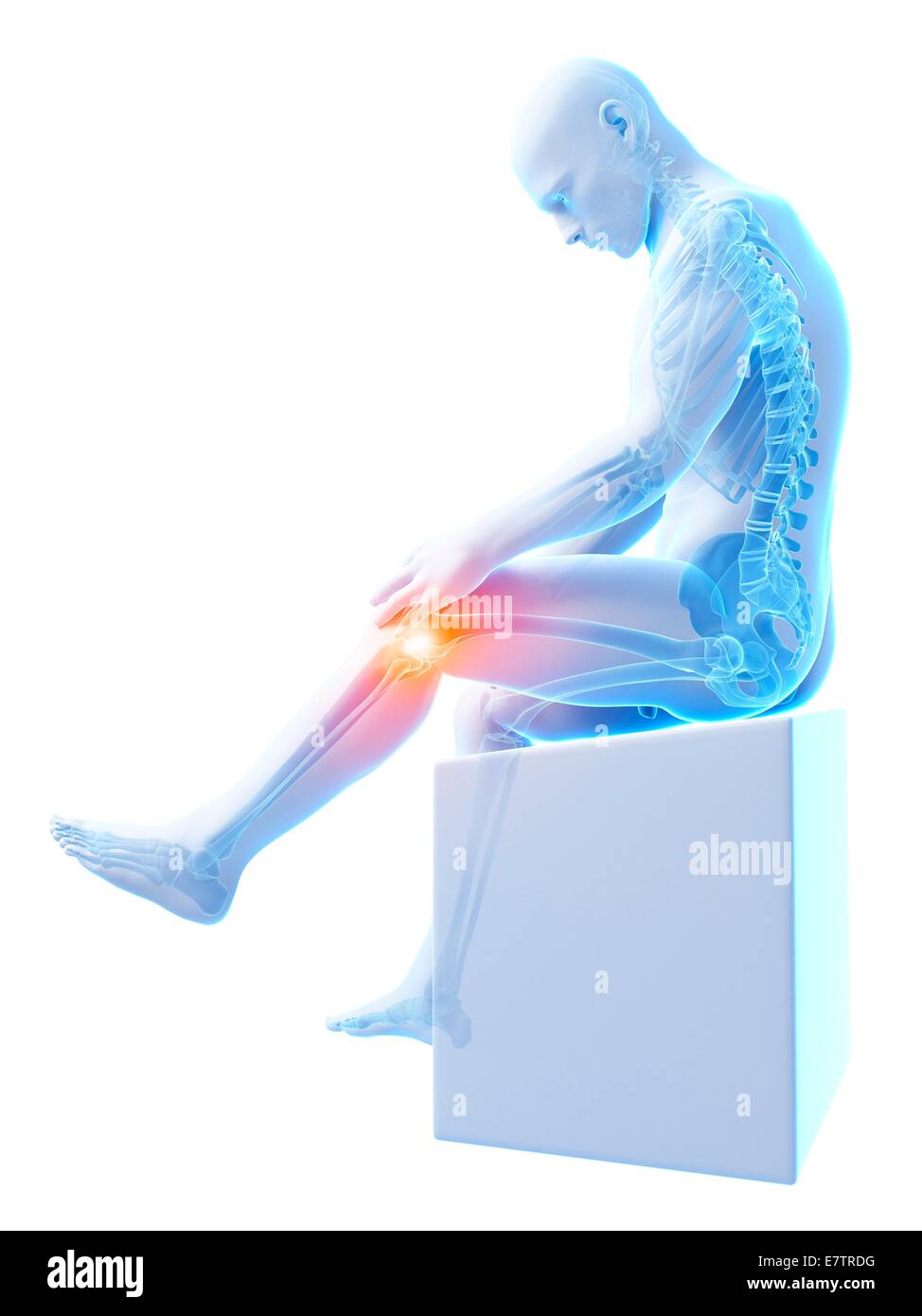 Human knee pain, computer artwork Stock Photo - Alamy