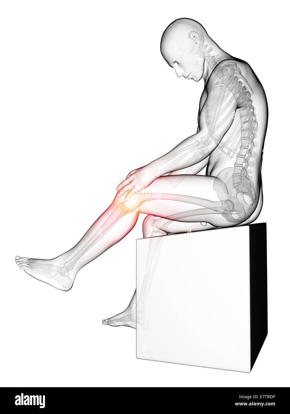 Human knee pain, computer artwork Stock Photo - Alamy