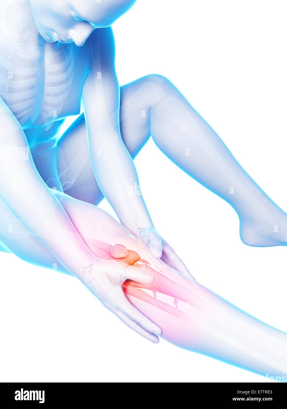 Human knee pain, computer artwork Stock Photo - Alamy