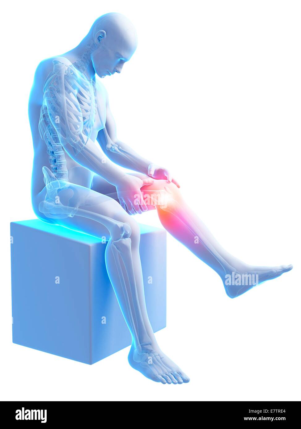 Human knee pain, computer artwork Stock Photo - Alamy
