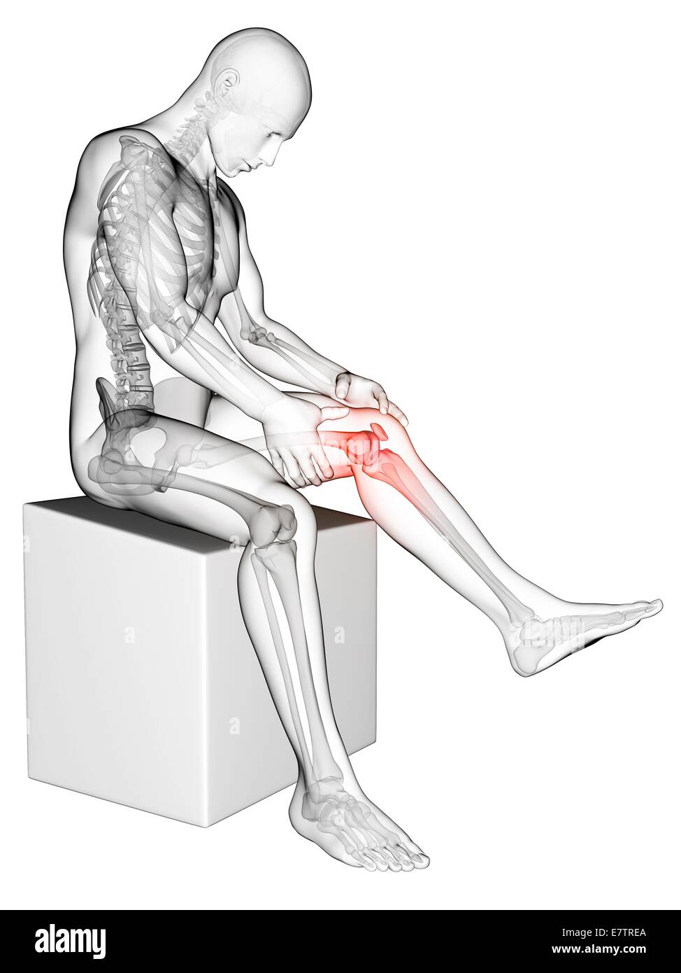 Human knee pain, computer artwork Stock Photo - Alamy