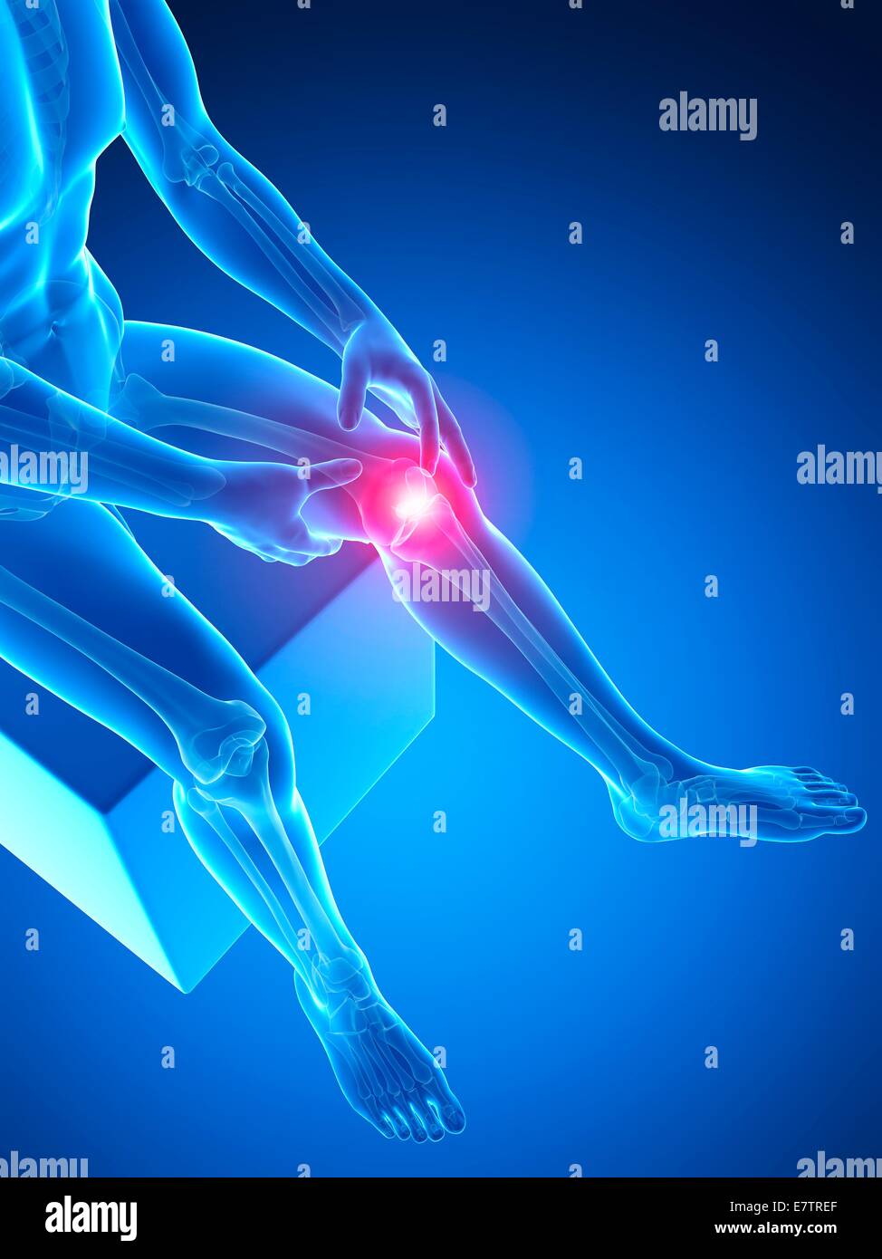 Human knee pain, computer artwork Stock Photo - Alamy