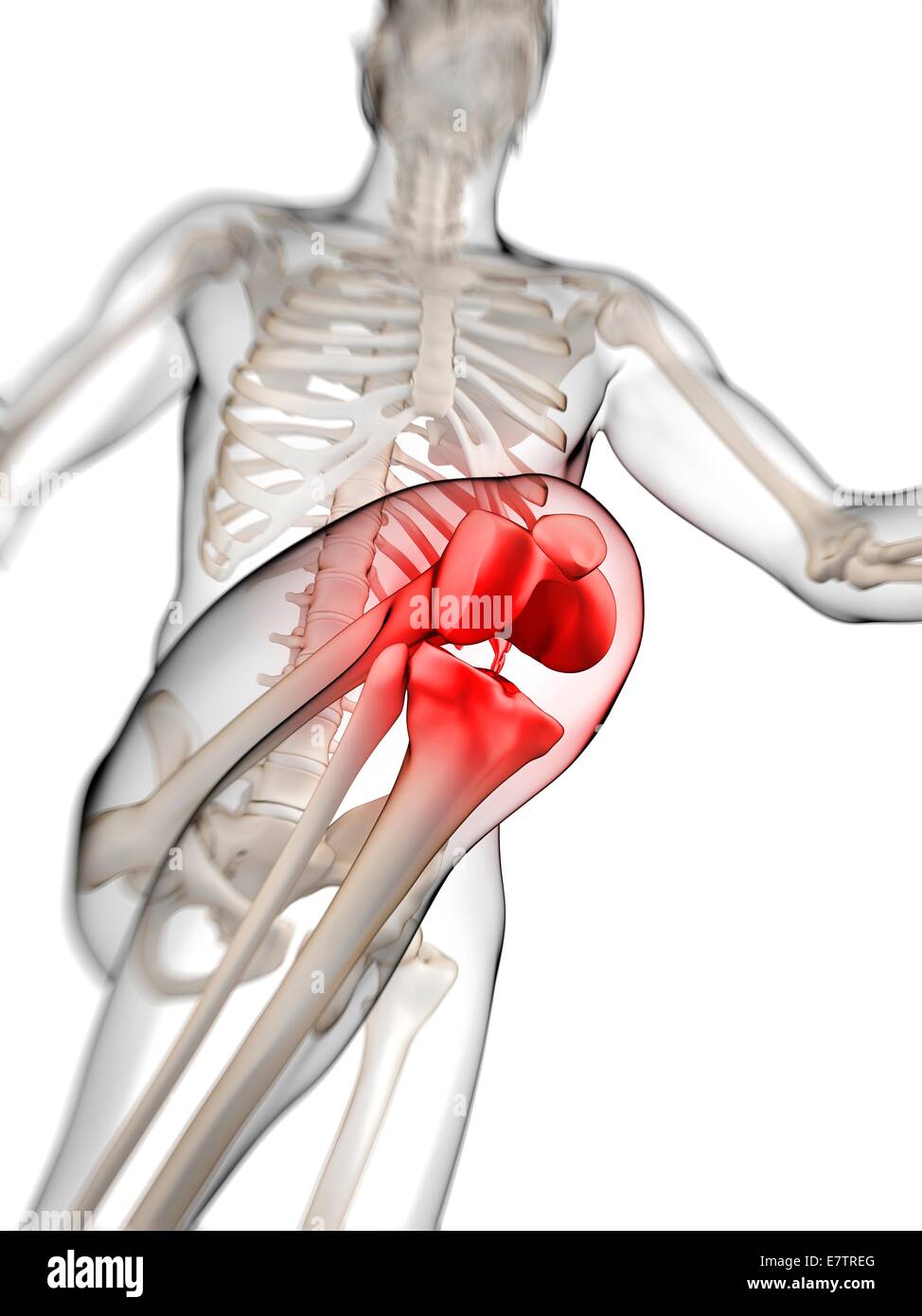 Human knee pain, computer artwork Stock Photo - Alamy