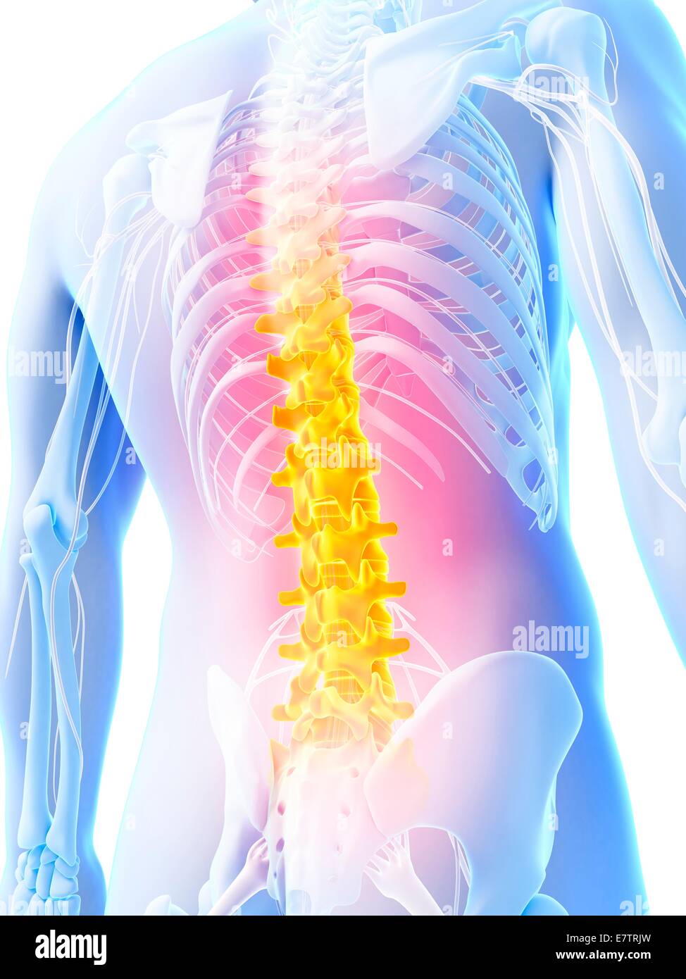 Human back pain, computer artwork Stock Photo - Alamy
