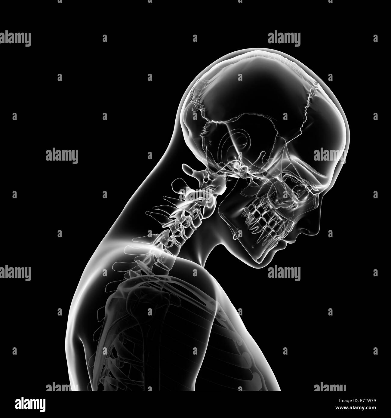 Human skull cervical spine illustration Black and White Stock Photos ...