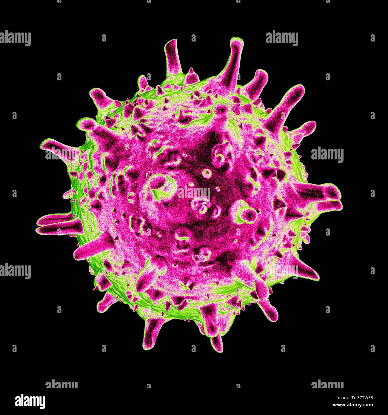 Severe acute respiratory syndrome (SARS), computer artwork Stock Photo ...