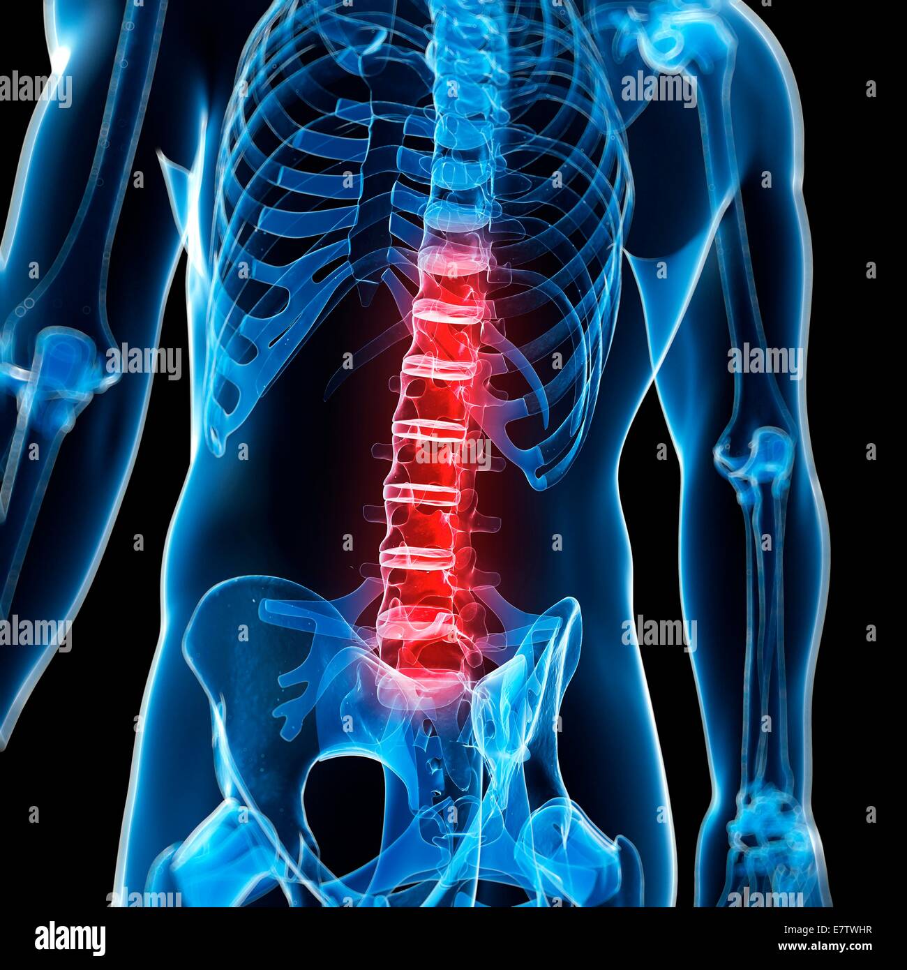 Human back hi-res stock photography and images - Alamy