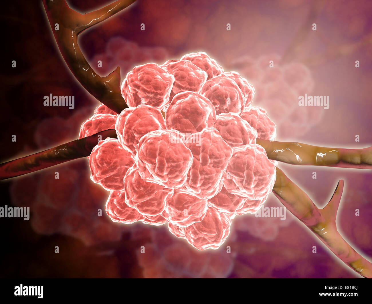 Microscopic view of Stachybotrys. Stachybotrys is a genus of molds ...