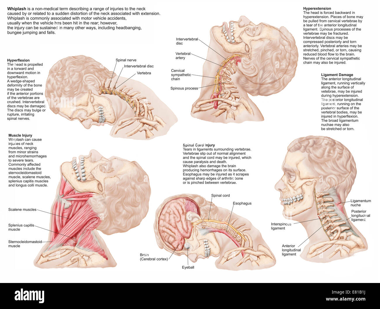 Human neck bones and muscle High Resolution Stock Photography and ...