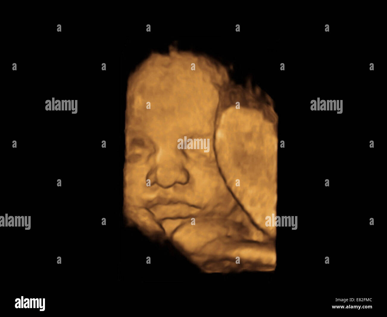 Foetus face coloured 3 d ultrasound hi-res stock photography and images ...