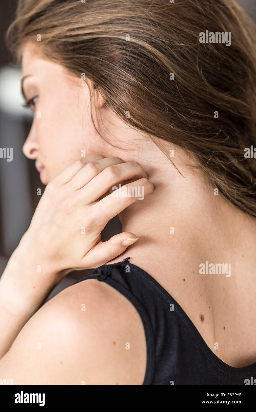 Psoriasis and neck hi-res stock photography and images - Alamy