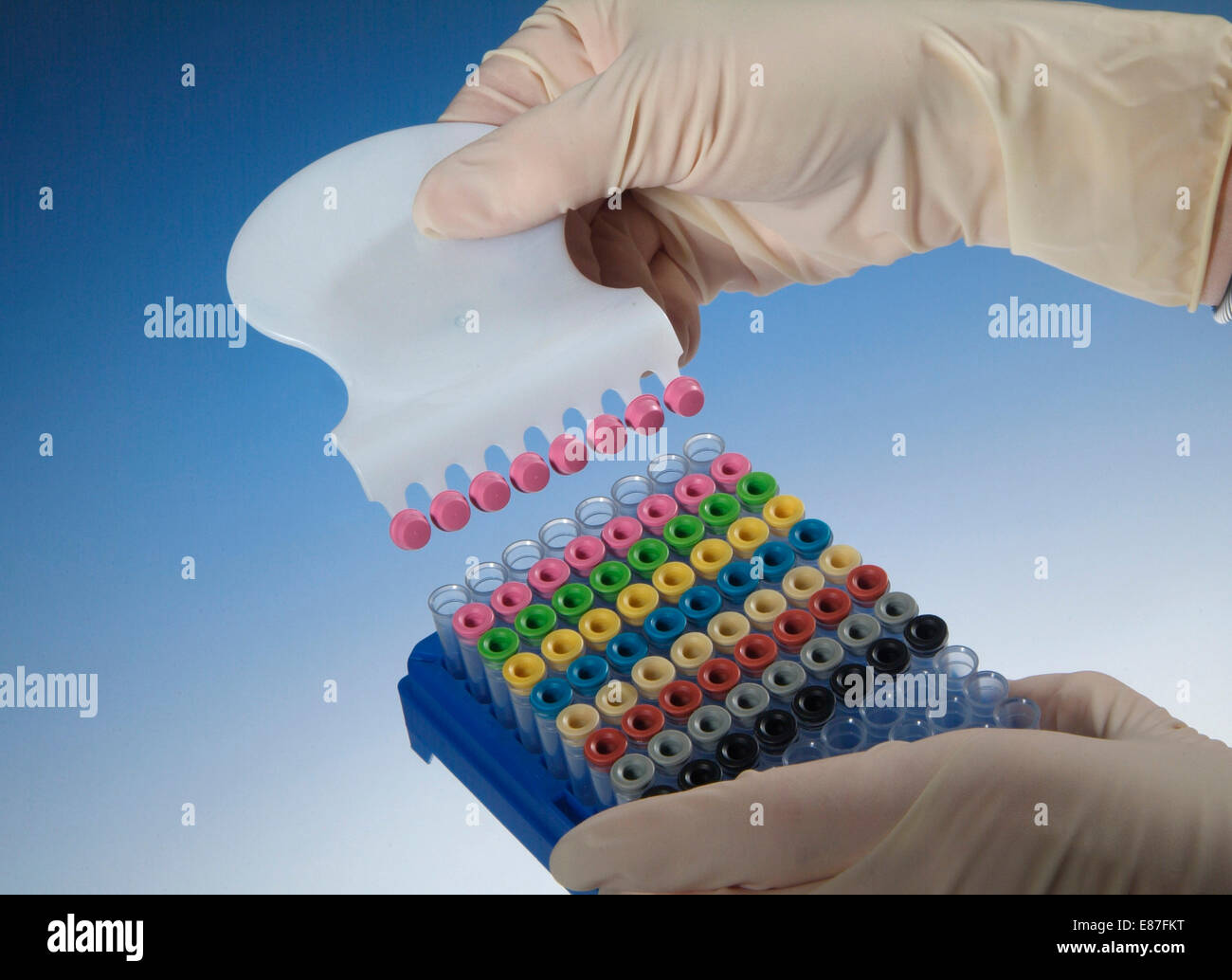 Medical testing tubes and apparatus Stock Photo - Alamy
