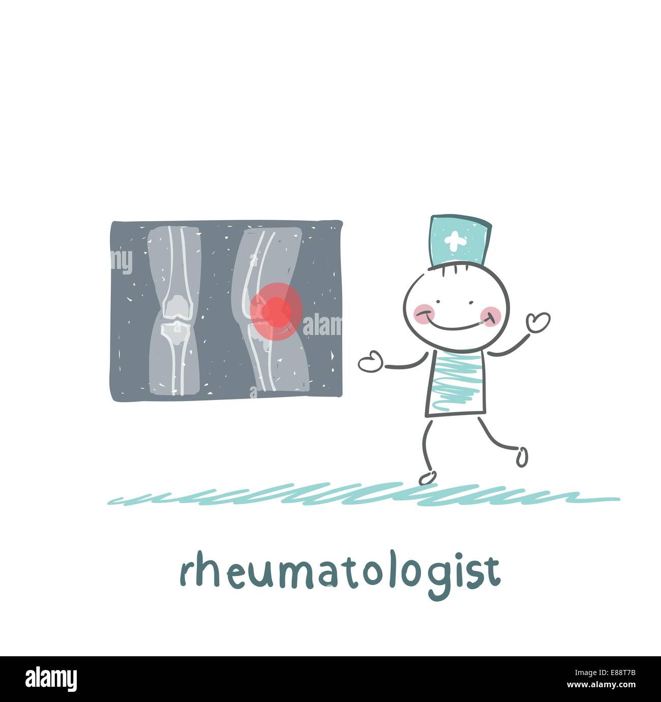 rheumatologist says about the pain in the joints of the feet and shows ...