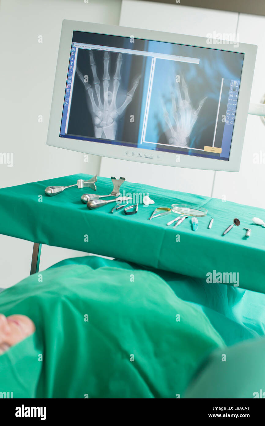 Woman lying on operating table hi-res stock photography and images - Alamy
