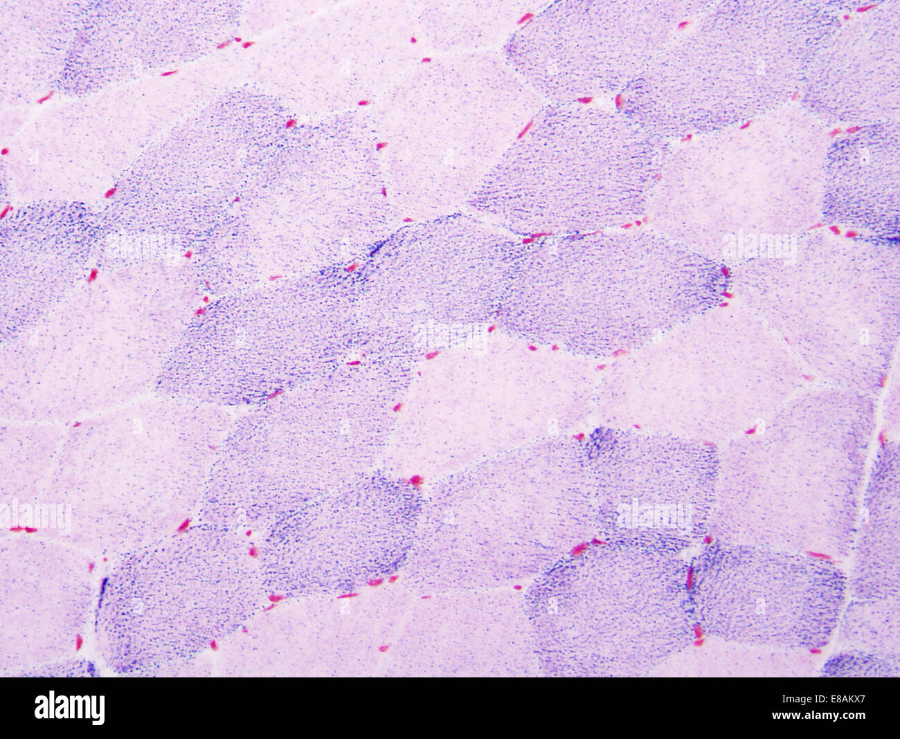 Human muscle cells hi-res stock photography and images - Alamy