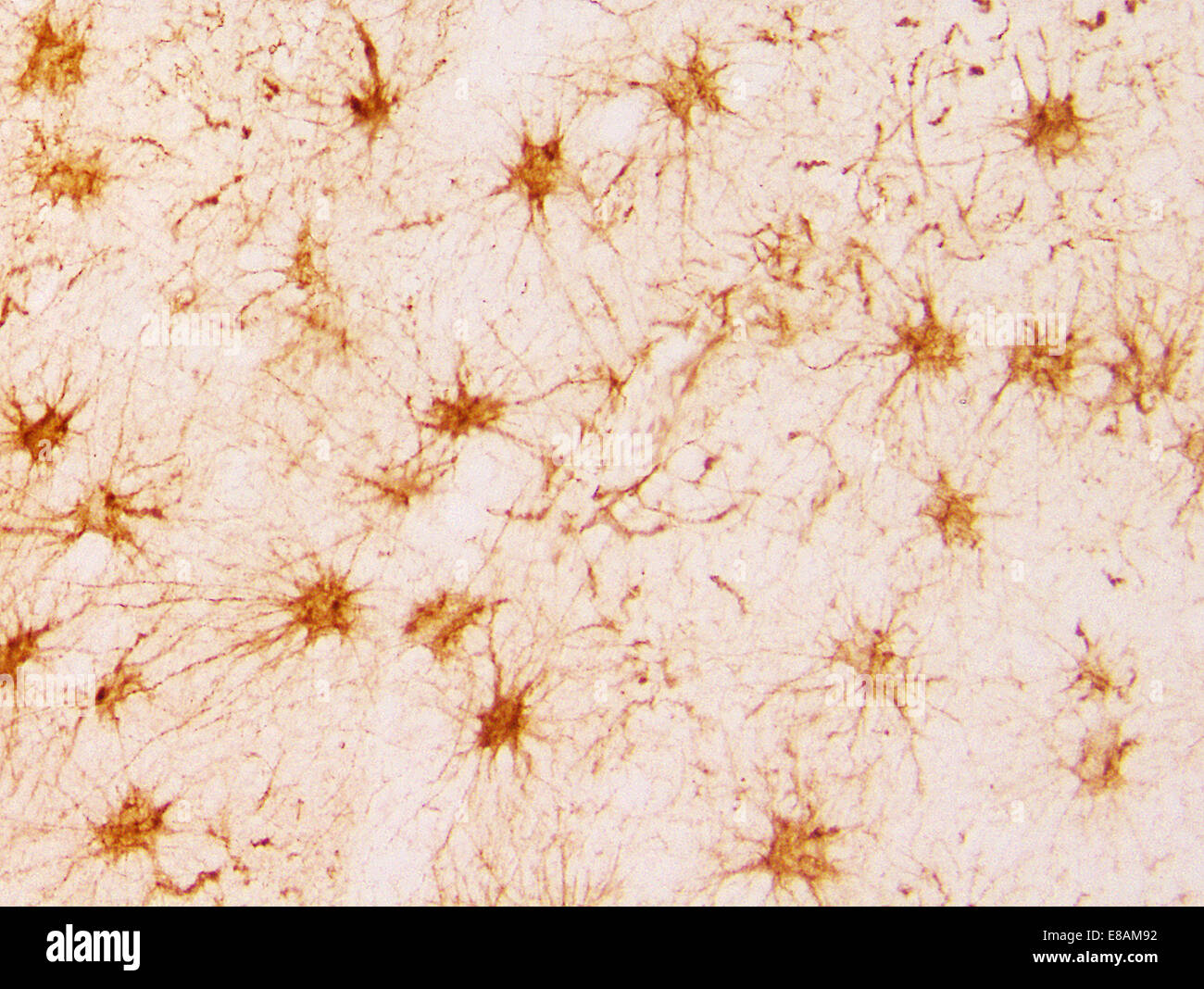 Astrocytes hi-res stock photography and images - Alamy
