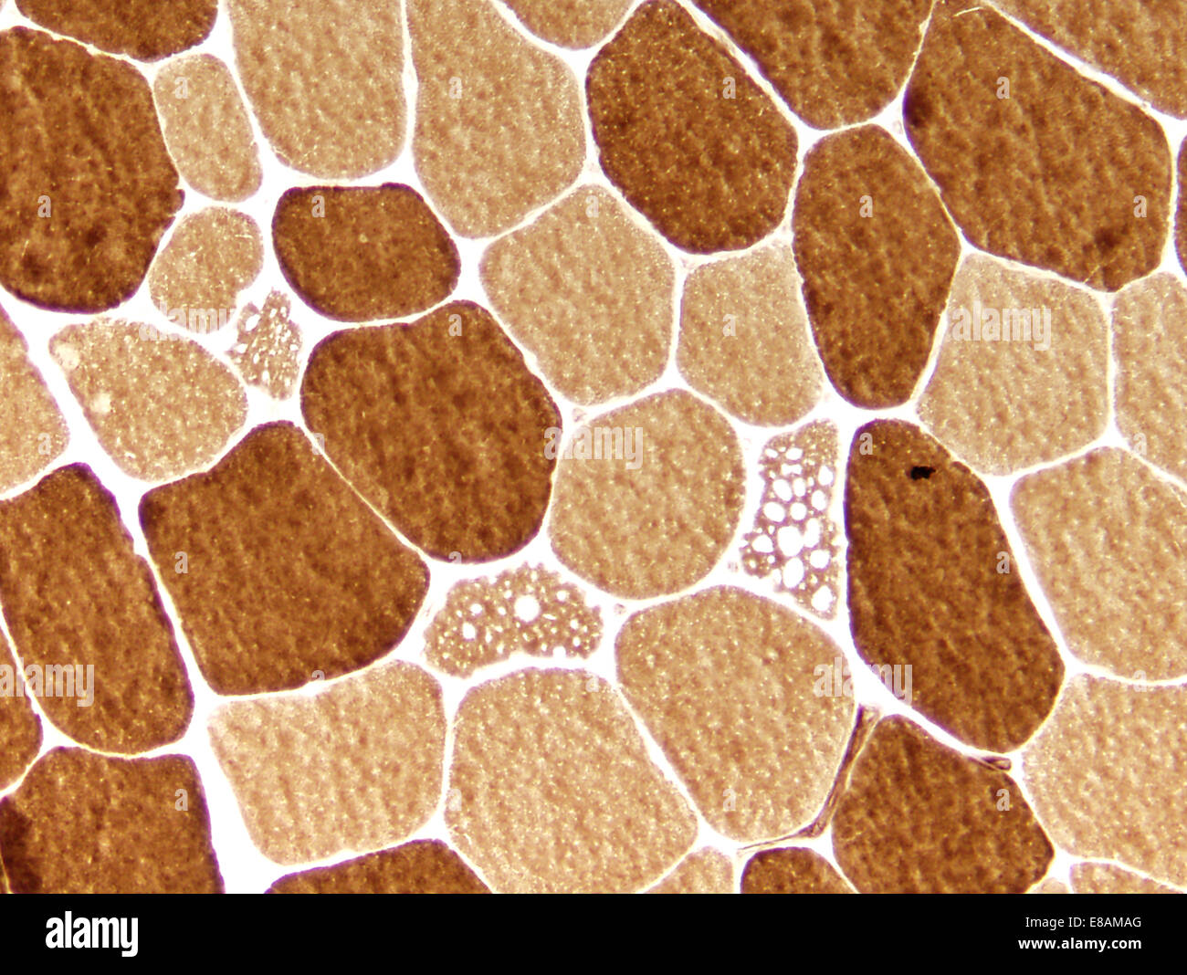 Glycogen hi-res stock photography and images - Alamy