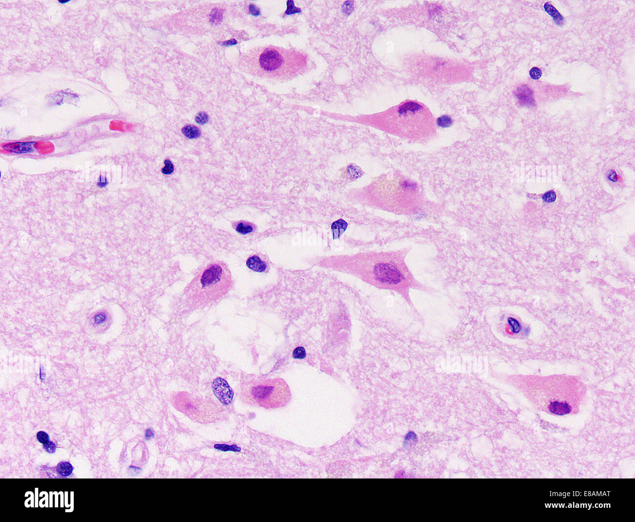 Brain cells micrograph hi-res stock photography and images - Alamy