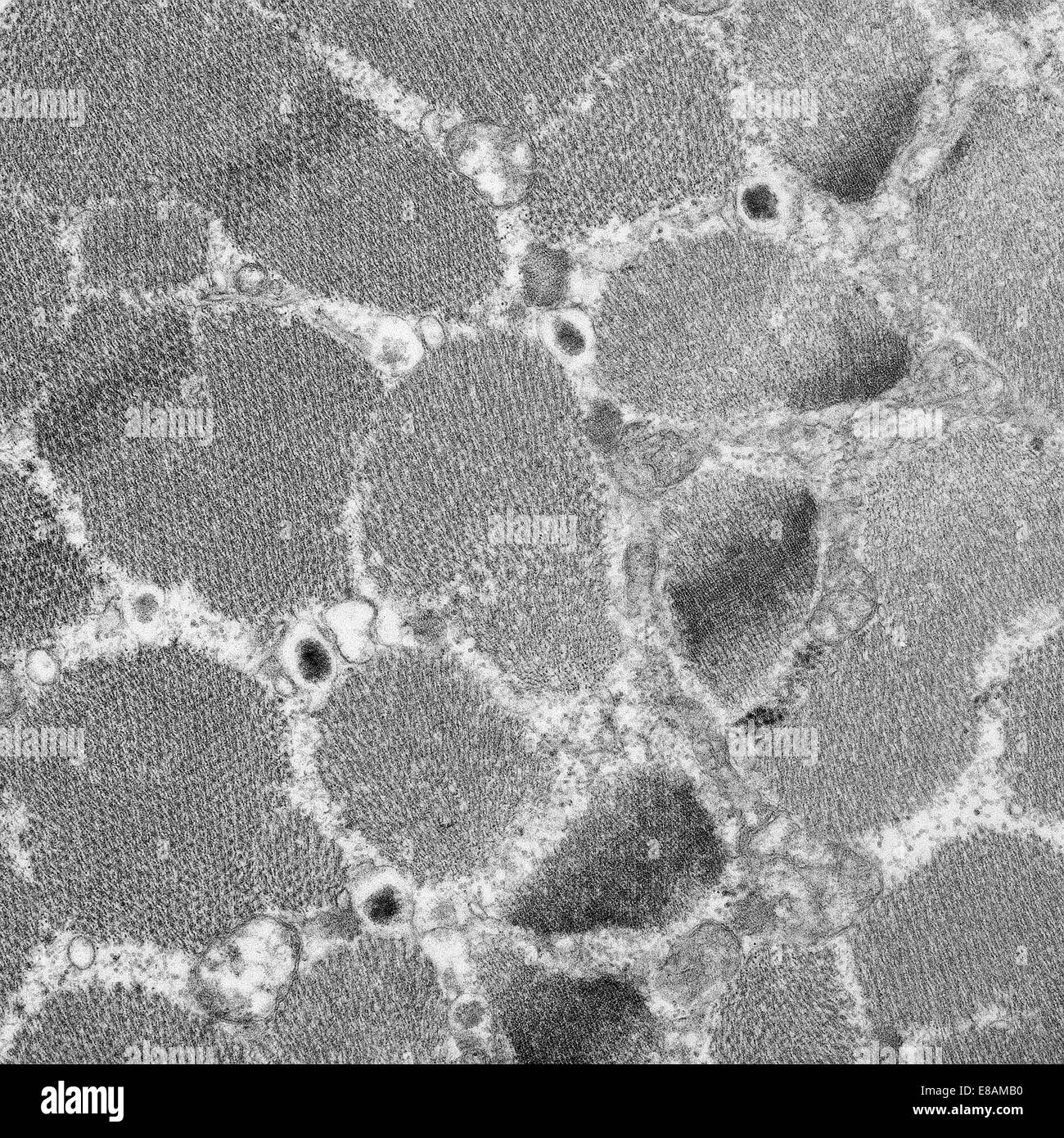 Electron microscopy normal human cell hi-res stock photography and ...