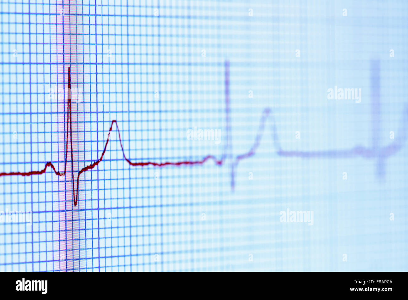 Electrocardiogram (pulse trace) displayed on a digital tablet screen ...