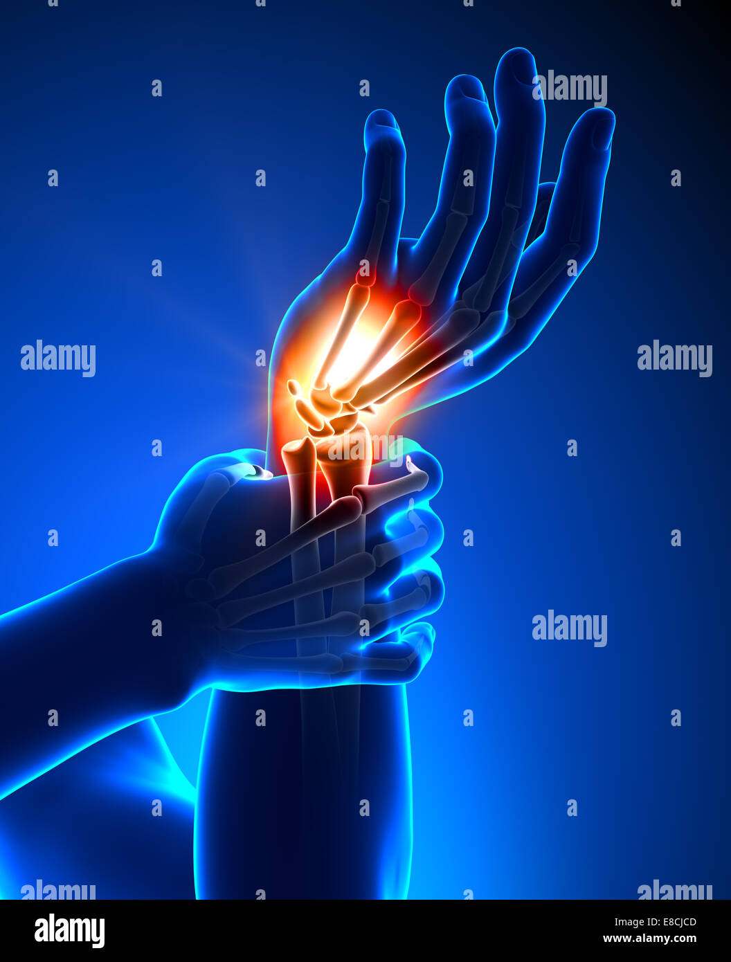 Wrist pain - detail Stock Photo - Alamy