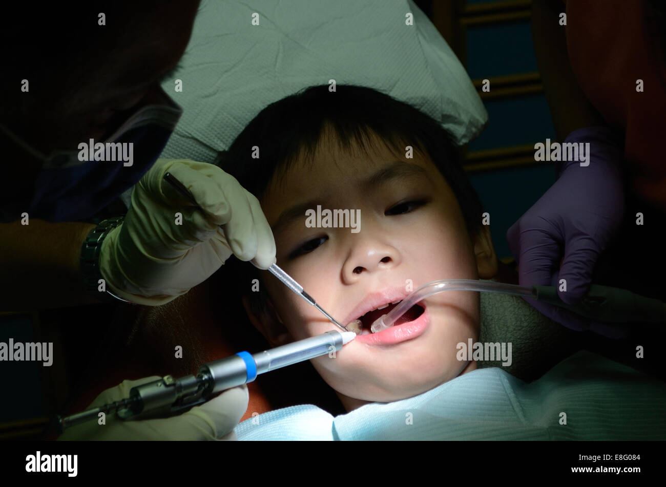 Tooth extraction hi-res stock photography and images - Alamy