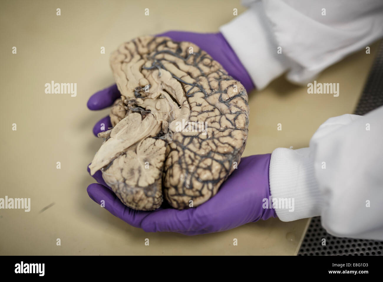 Human brain dissect for medical test dementia Stock Photo - Alamy