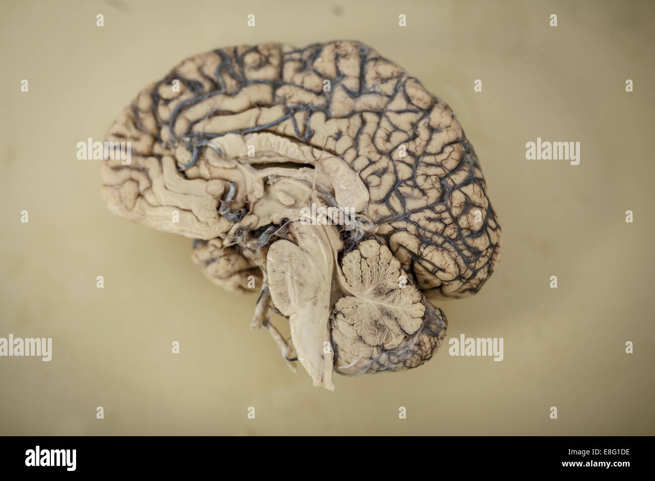 Human brain dissect for medical test dementia Stock Photo - Alamy
