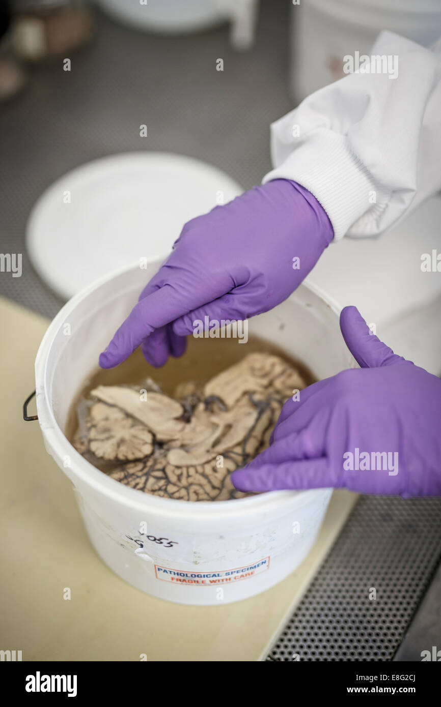 Human brain dissect for medical test dementia Stock Photo - Alamy