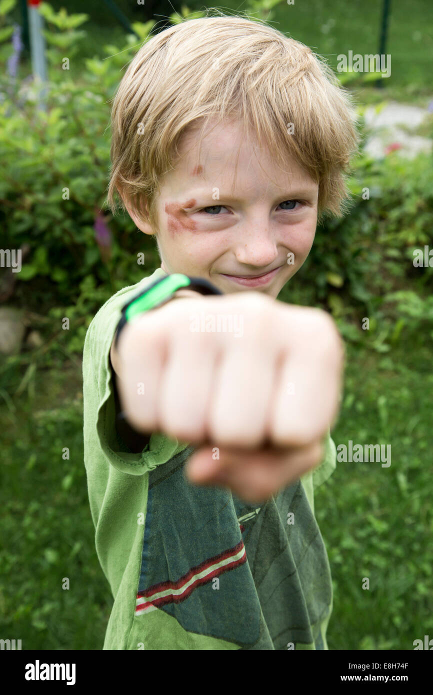 Portrait of boy with graze in his face showing fist Stock Photo - Alamy