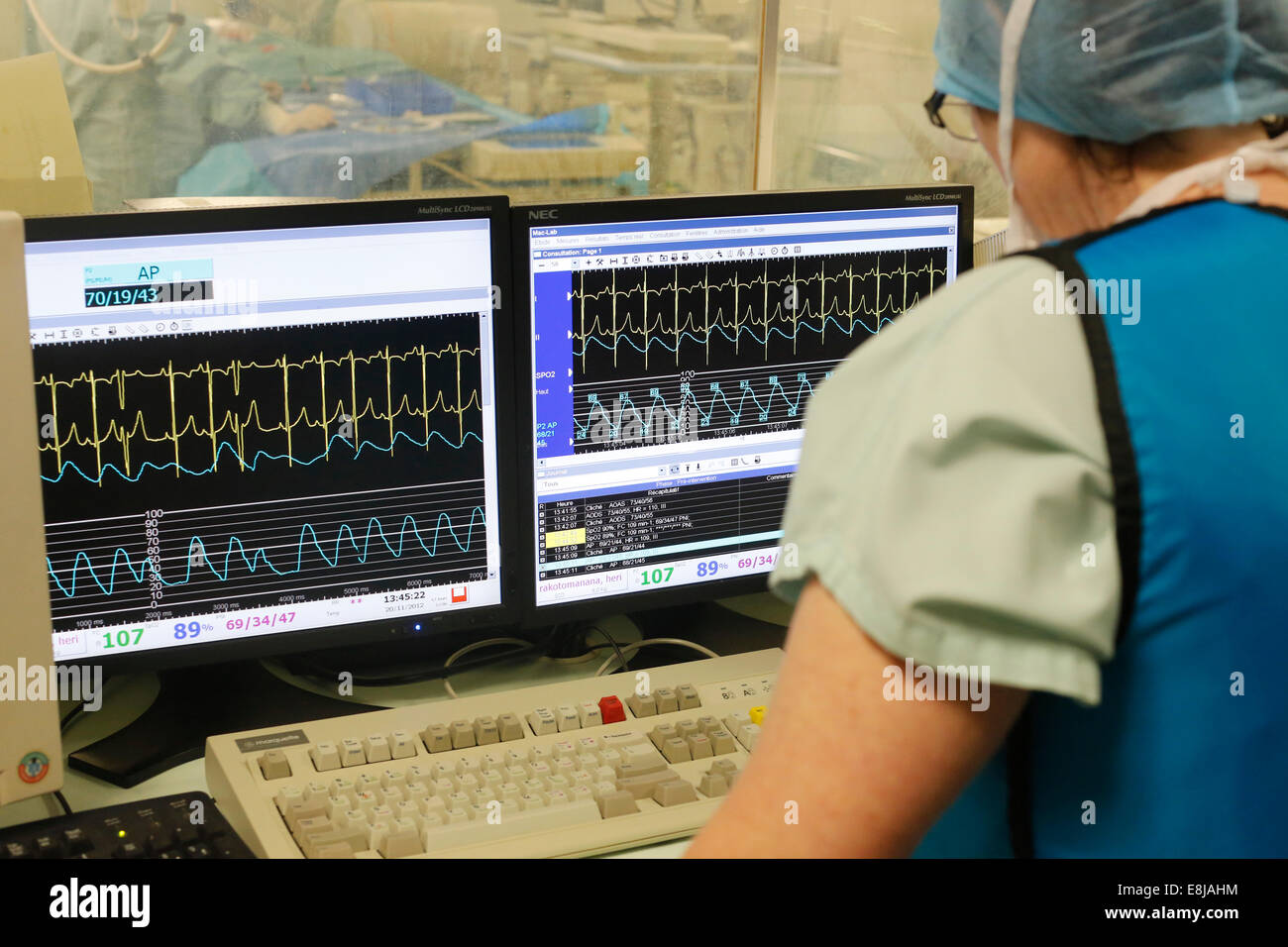 Heart surgery monitoring (catheterism Stock Photo - Alamy
