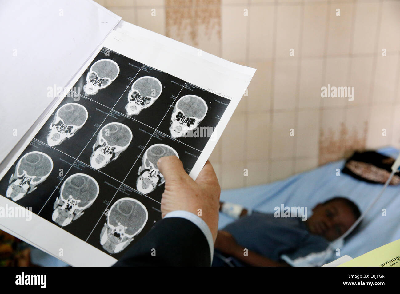 Libreville Hospital. Sick child. Scanner Stock Photo - Alamy