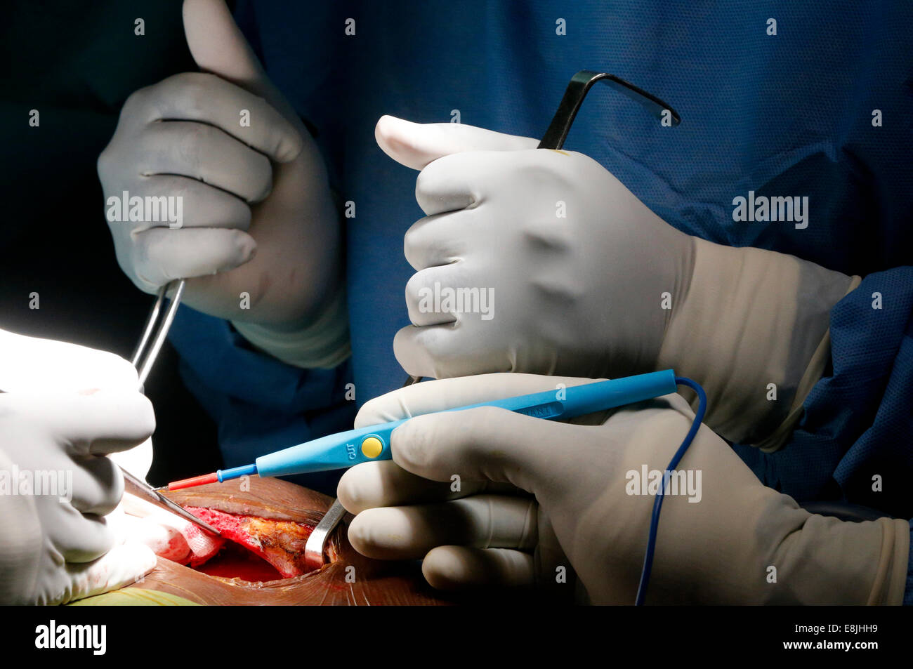 Operating theatre hi-res stock photography and images - Alamy