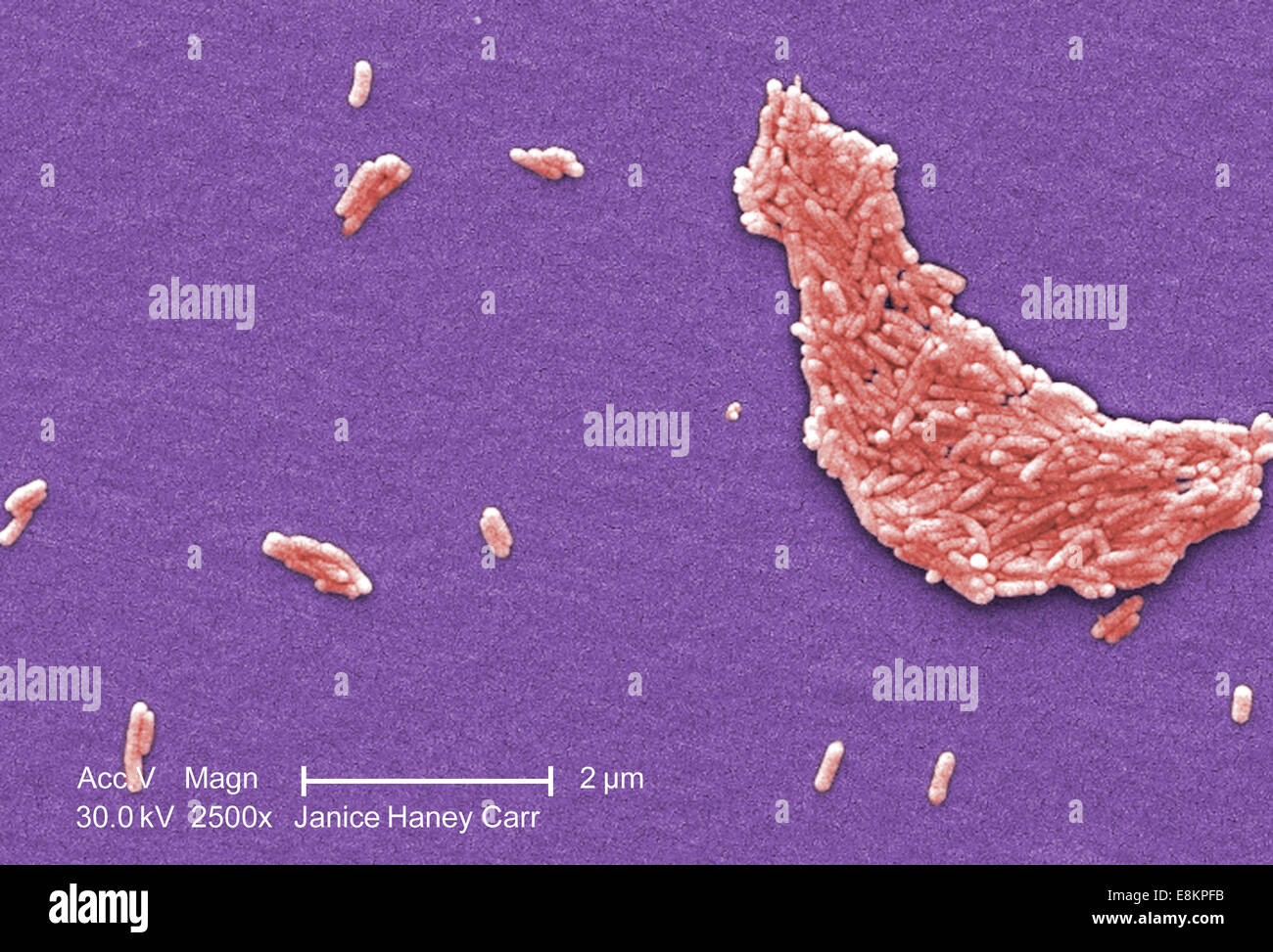 Under magnification of 2500X, this colorized scanning electron ...