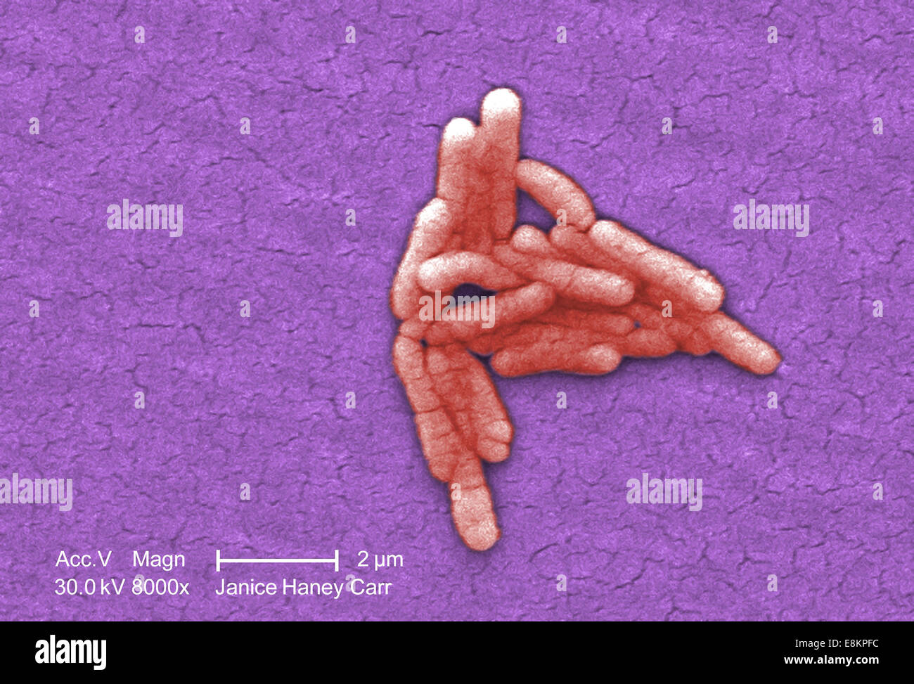 Under moderately-high magnification of 8000X, this colorized scanning ...