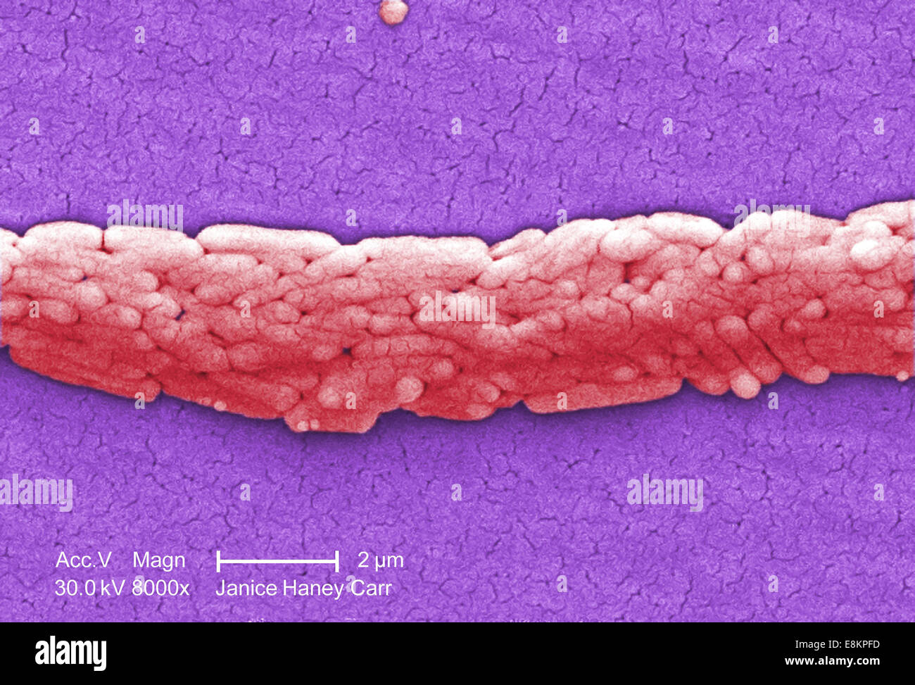 Bacteria Under Microscope Stock Photos & Bacteria Under Microscope ...