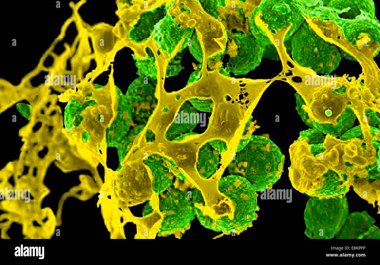 Scanning electron micrograph of methicillin-resistant Staphylococcus ...