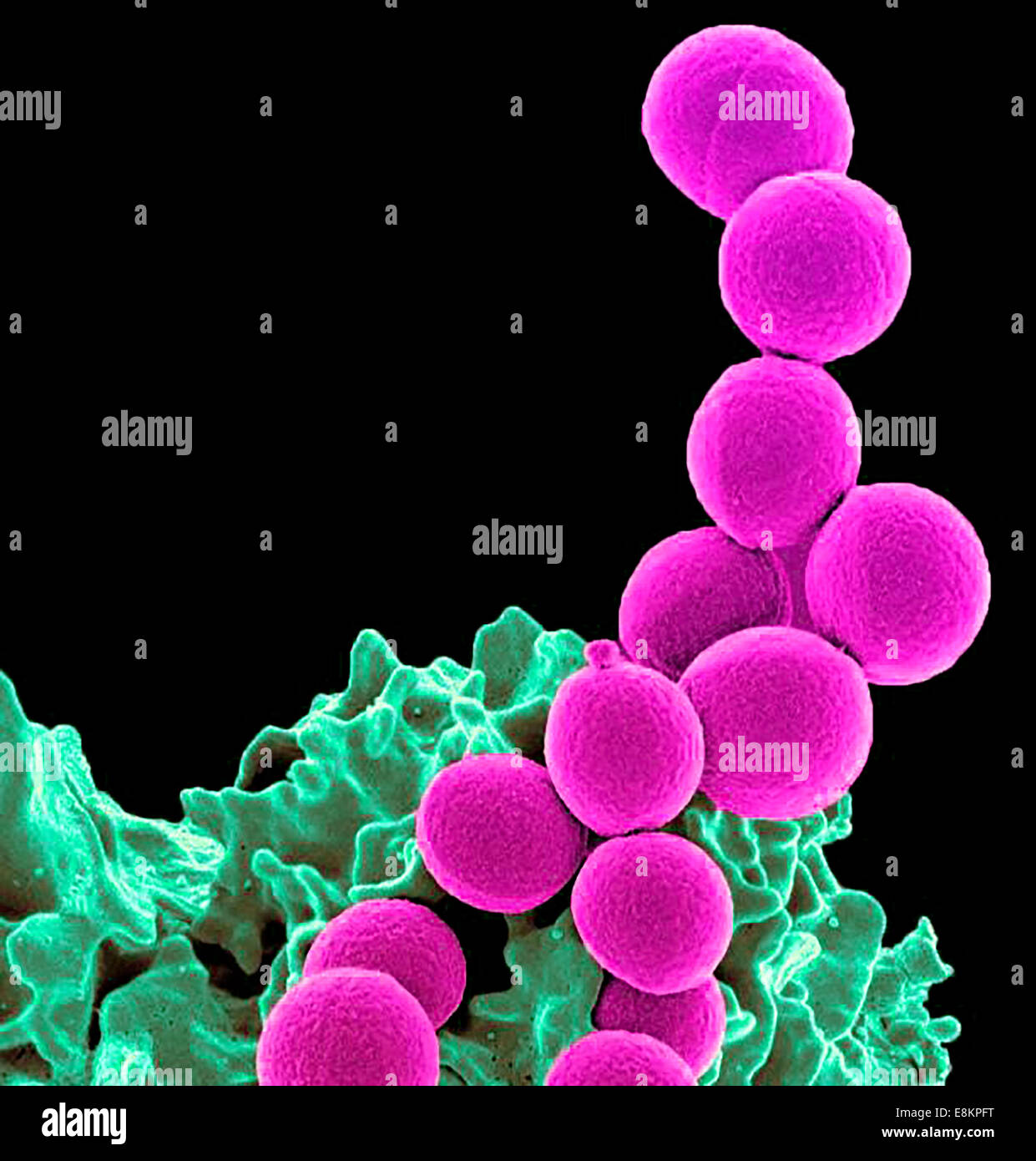 Mrsa Bacteria Under Microscope