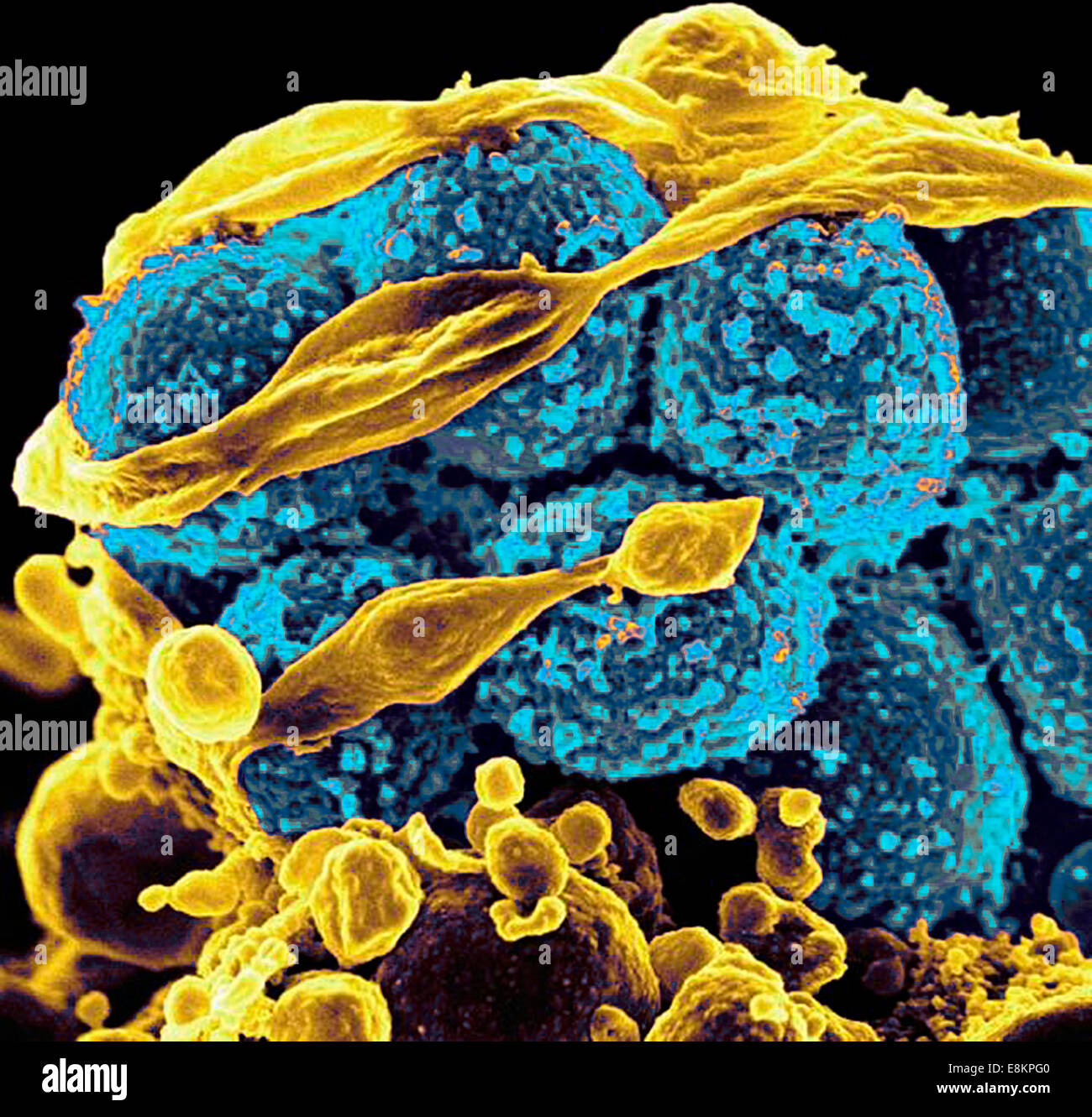 Bacterial Cells Staphylococcus Aureus High Resolution Stock Photography ...