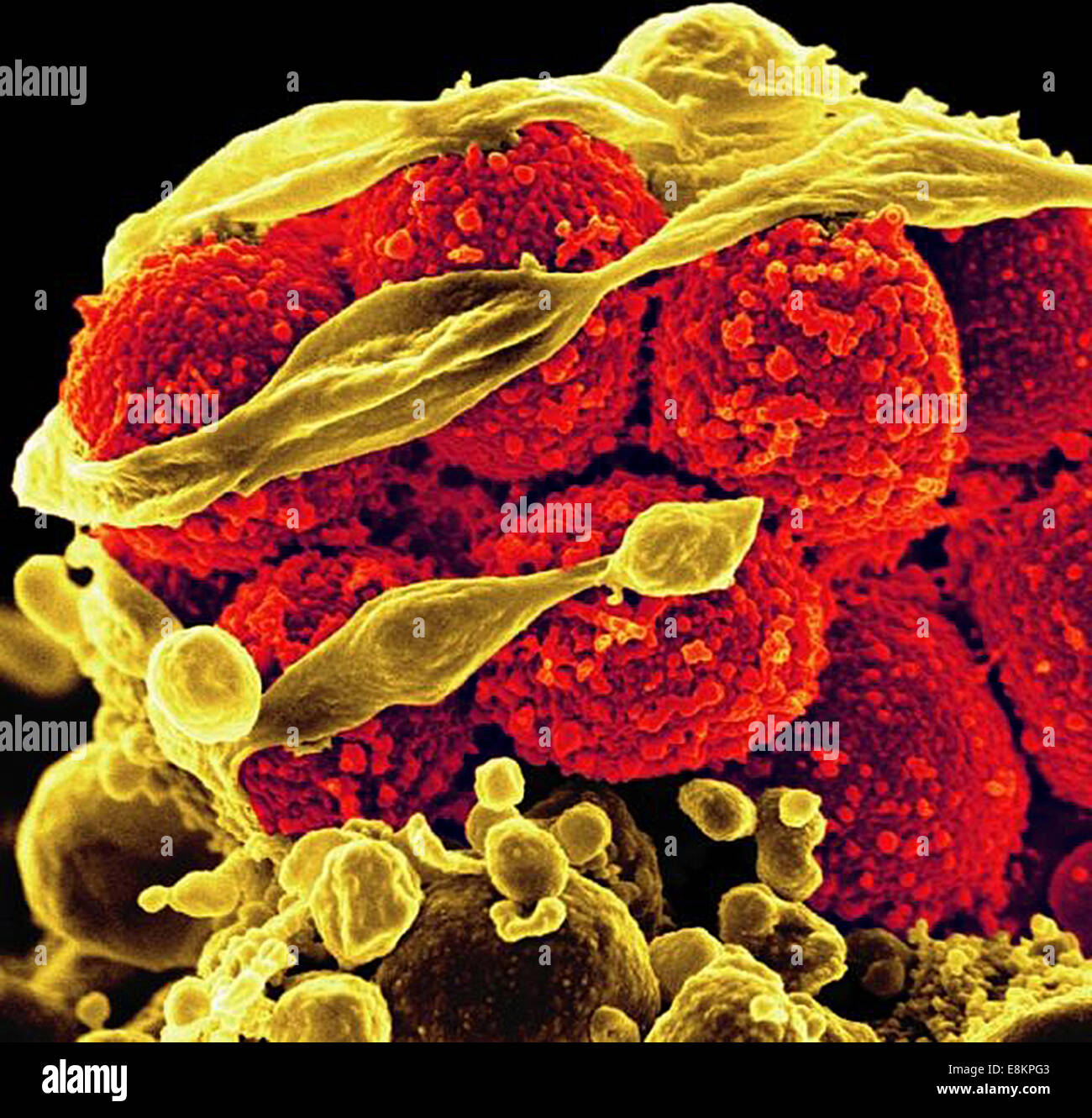 Scanning electron micrograph of methicillin-resistant Staphylococcus ...