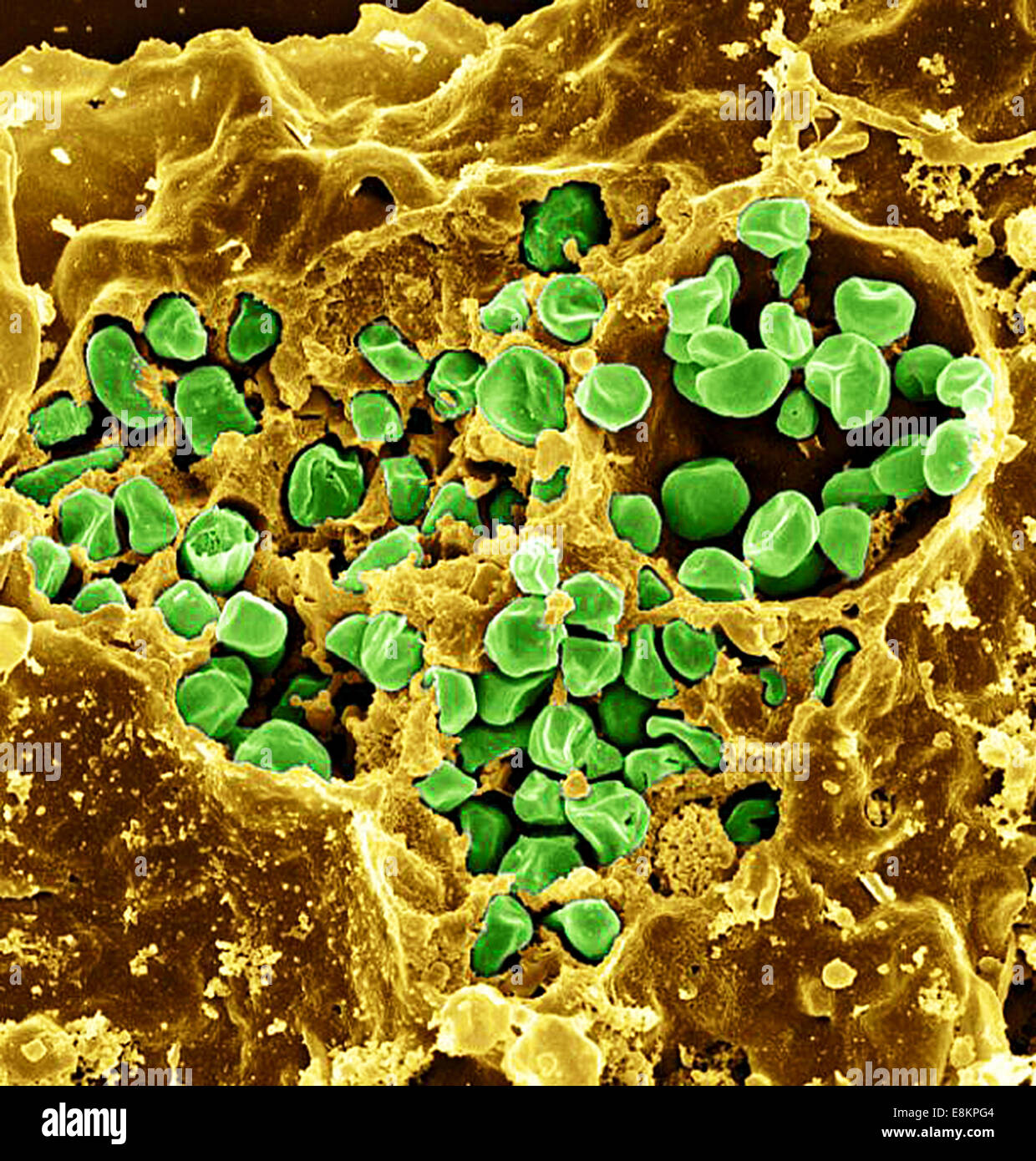 Macrophage bacteria hi-res stock photography and images - Alamy