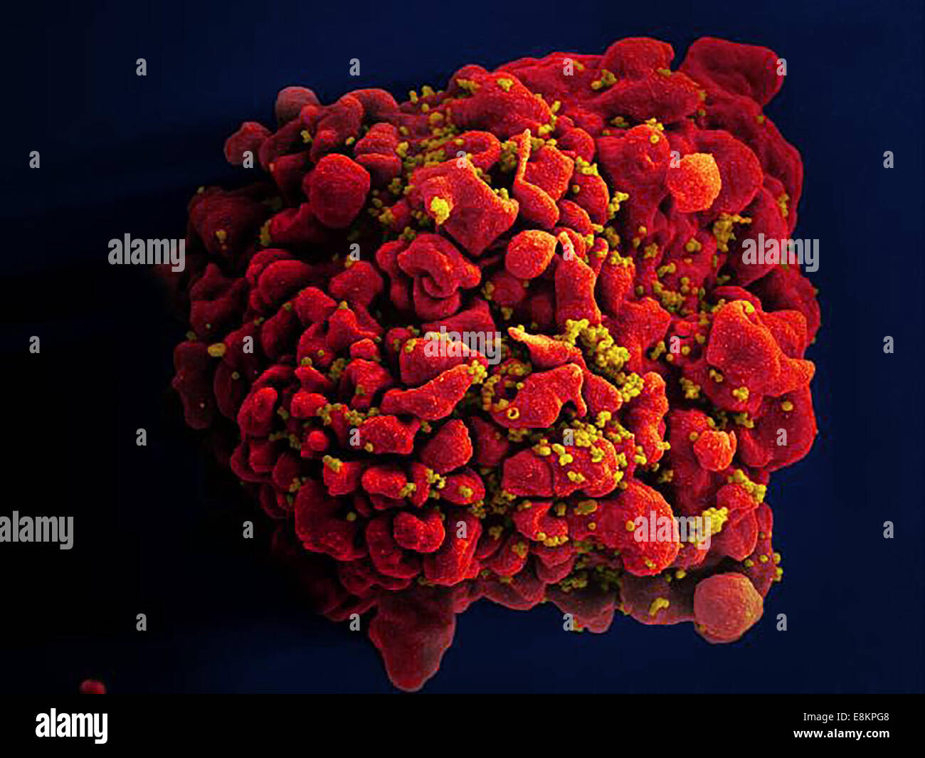 Scanning electron micrograph of an HIV-infected H9 T cell Stock Photo ...