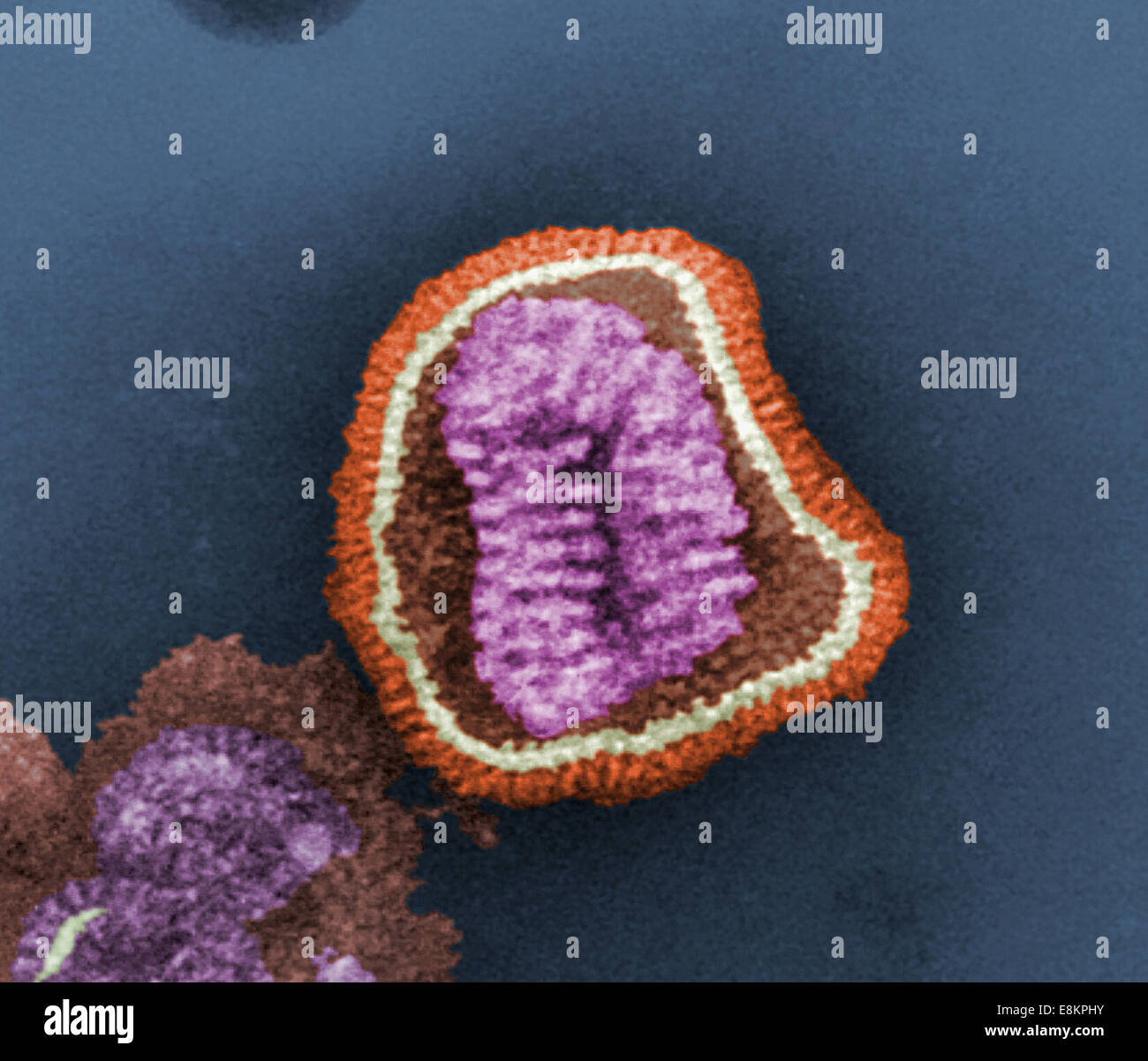 This colorized negative-stained transmission electron micrograph (TEM ...